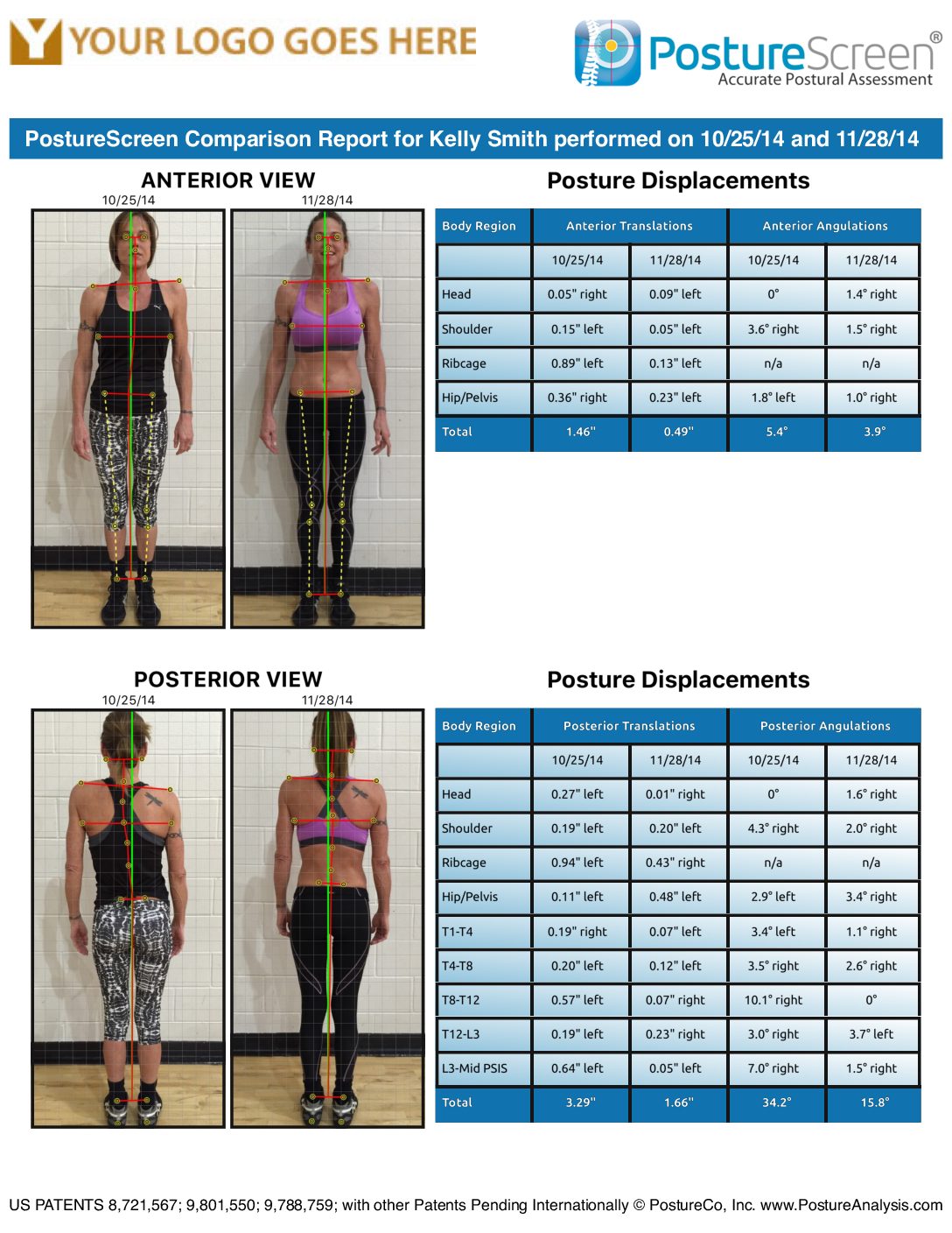 Advanced4view_Comparison_PostureScreen | PostureCo, Inc. PostureScreen ...