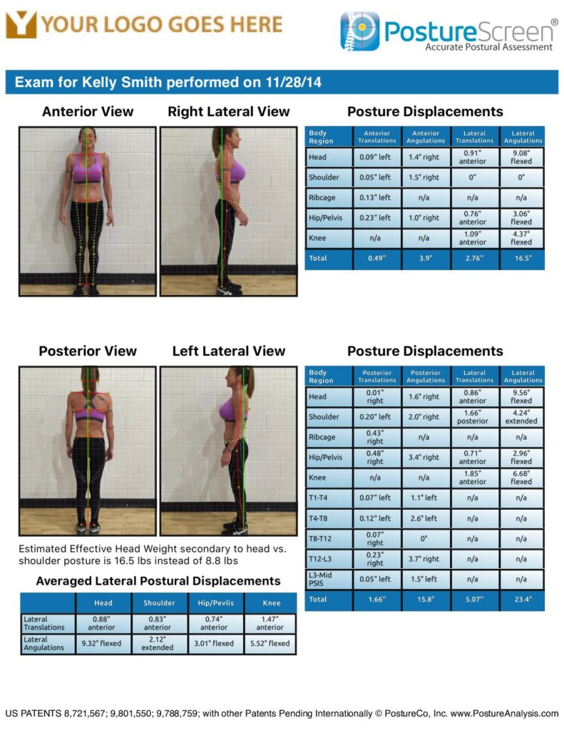 Advanced4view_Initial_PostureScreen | PostureCo, Inc. PostureScreen ...