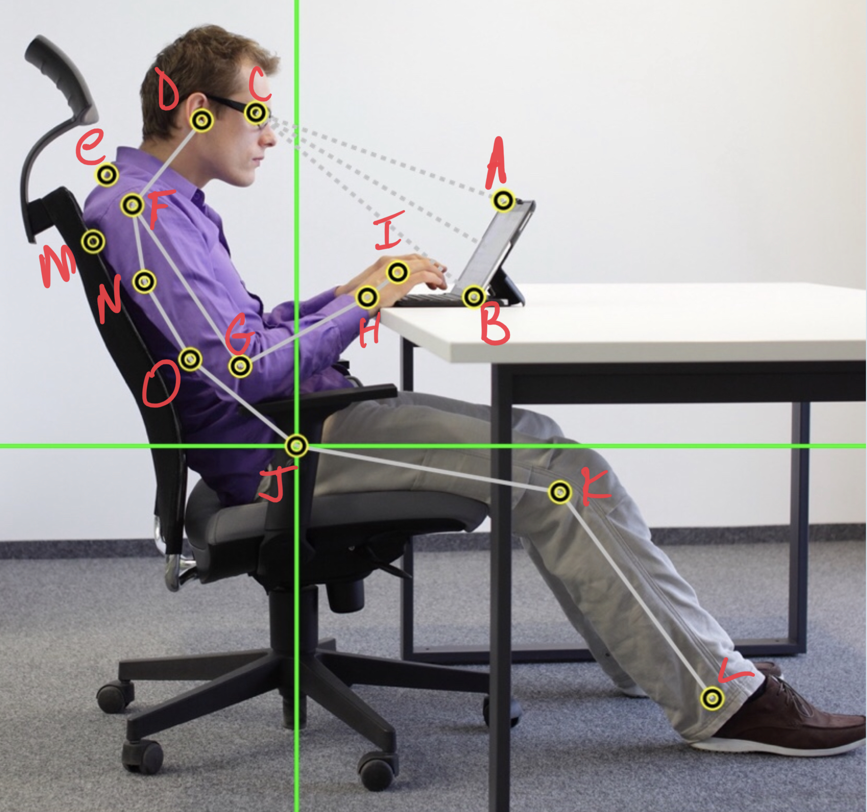 SitScreen Anatomical Landmarks and Measurements - PostureScreen ...