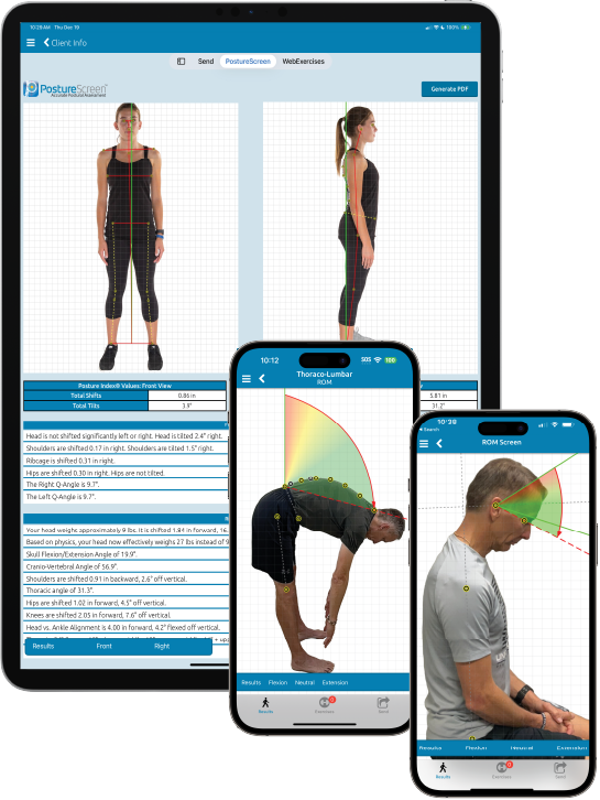 AP Modified Ferguson View (Short Leg Analysis) – CBP Technique ...